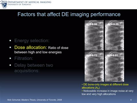 Dual Energy Imaging And Digital Tomosynthesis Innovative X Ray Based