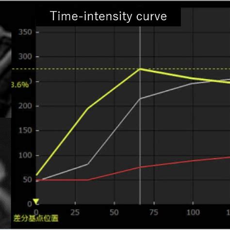 Time Intensity Curve Regions Of Interest Were Placed At The Following Download Scientific