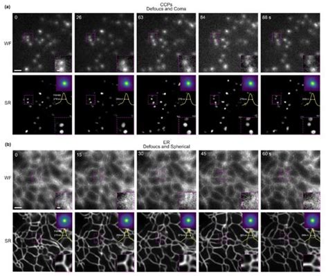 Deep Learning Based Optical Aberration Estimation Enables Offline Digital Adaptive Optics And