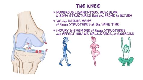 Video Anatomy Clinical Correlates Knee Osmosis