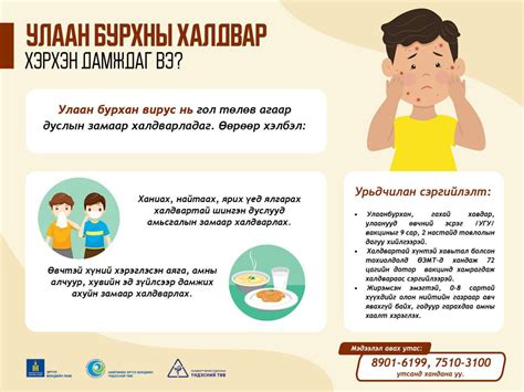 Нийгмийн УЛААНБУРХАН ӨВЧИН ГЭЖ ЮУ ВЭ Улаанбурхан гэдэг нь нусгайрах халуурах нүд үрэвсэх