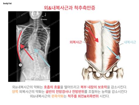 옆구리 근육 외복사근 And 내복사근 네이버 블로그