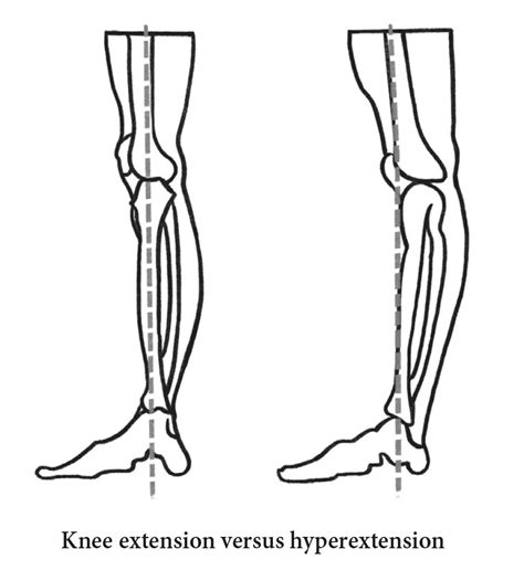 Hyperextension Movement