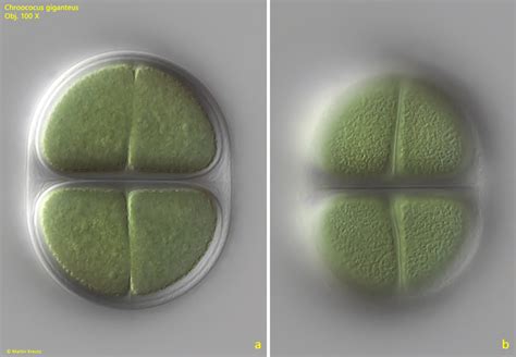 Chroococcus Giganteus Real Micro Life