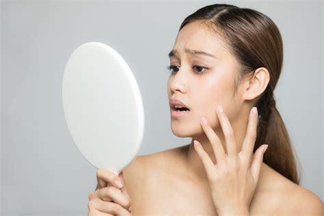 4 Skin Problems And Their Treatments 4 Common Skin Problems And How To Treat Them