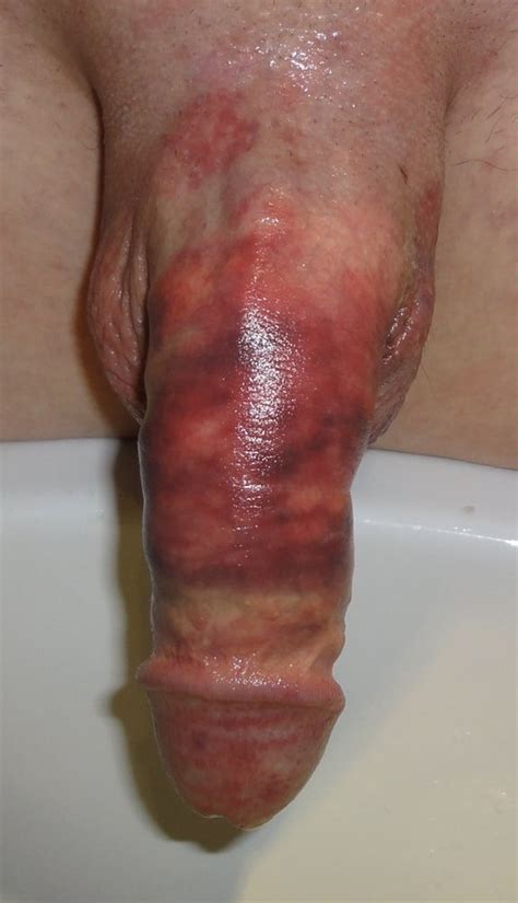 Cock Crushed Porn Pictures Xxx Photos Sex Images 4049982 Pictoa Cock Crushed Porn Pictures Xxx Photos Sex Images 4049982 Pictoa