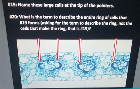 Answered 19 Name These Large Cells At The Tip Bartleby