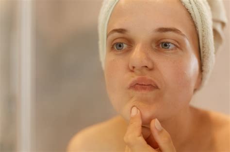 Does Glycolic Acid Unclog Pores