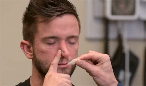 Trochlear Nerve Cranial Nerve Iv Cn Iv Assessment 51 Off