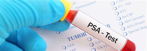 Prostate Specific Antigen Psa Test Moffitt