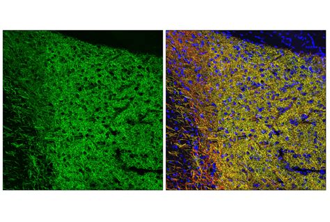 Dopamine Transporterdat E3u7r Rabbit Mab Cell Signaling Technology