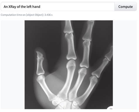 Generative Ai In The Medical Domain Not Quite Yet Edge Ai And Vision Alliance