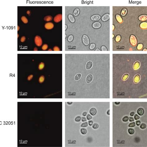 Microscopy Of Oleaginous Yeasts Micrographs Show Fluorescent Lipid Download Scientific Diagram