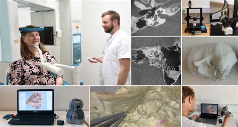 Temporal Bone Imaging And Simulation Research Group