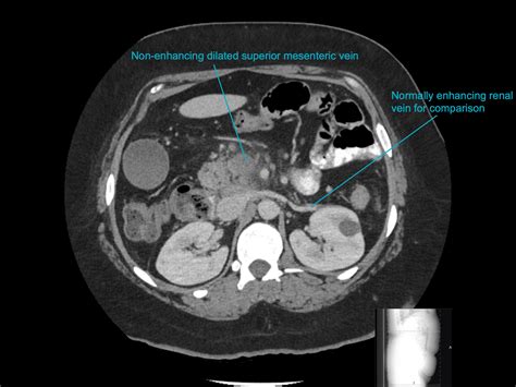 CT Case LITFL CT Scan Interpretation
