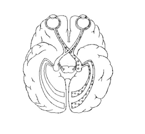 Visual Pathway Diagram Quizlet