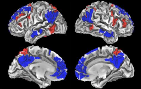 Default Mode Network Blue And Dorsal Attention Network Red From The