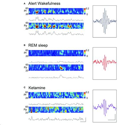 Spectrograms By Means Of The Wavelet Function And Rectified Gamma