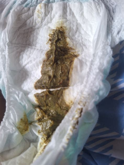 Tolong Bantu Jelasin Dong Momi Momi Saya New Mom Knpa Hellosehat