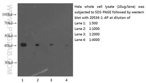 Loading Control Antibodies For Western Blotting Proteintech Group