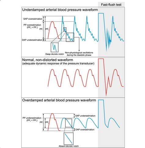 Abnormal Cvp Waveform