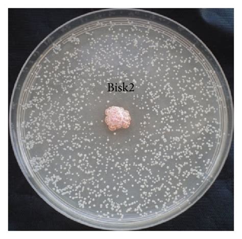 Antimicrobial Activity Of Some Strains Among The Selected Strains A Download Scientific