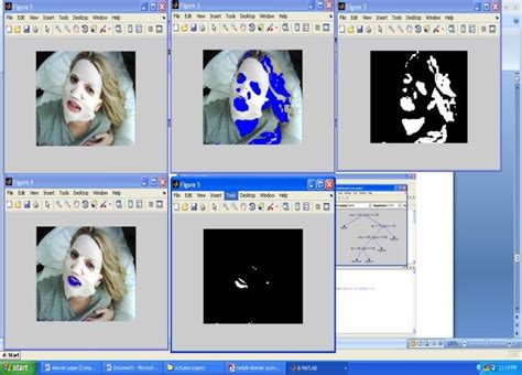Occlusion Detection Using Decision Tree C5 0 Algorithm Download