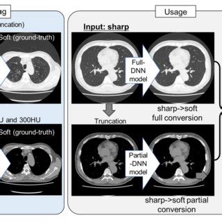 Protocol For The Present Sharp To Soft Kernel Image Conversions Using Download Scientific
