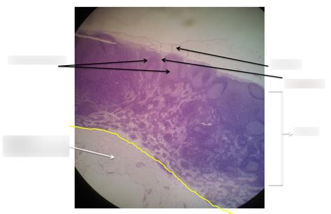 Lymph Node Microscope Labeling Diagram Quizlet