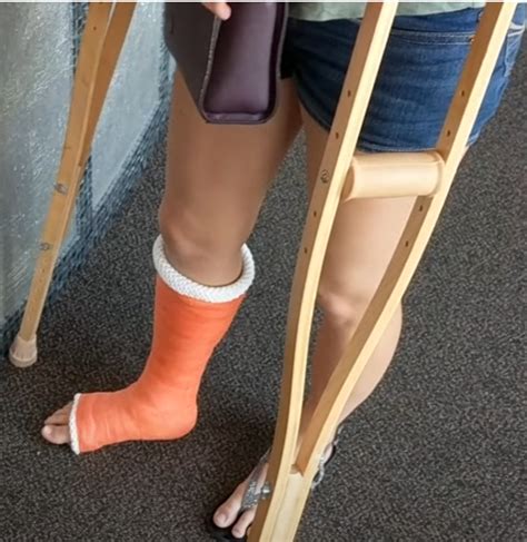 Stephanie Gets Her Casted Toes Done Network For Casters