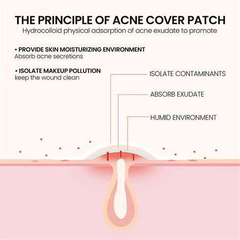 Pimples Patch Jaysuing Cosmetics Original Patch Hydrocolloid Acne Pimples Patch Jaysuing Cosmetics Original Patch Hydrocolloid Acne