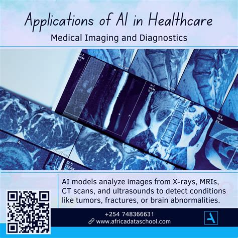 Africa Data School On Linkedin Aimedicalimaging Healthcareinnovation Earlydetection