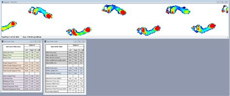 What Information Does A Tekscan Gait Analysis System Provide Tekscan