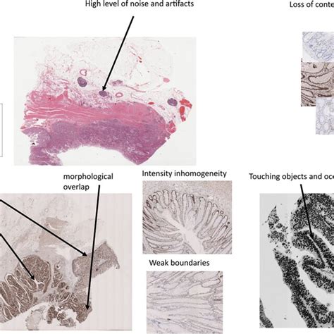 The Architecture Of Decompose Transfer And Compose Detrac Model