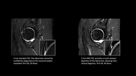 Simultaneous Multi Slice Siemens Healthineers
