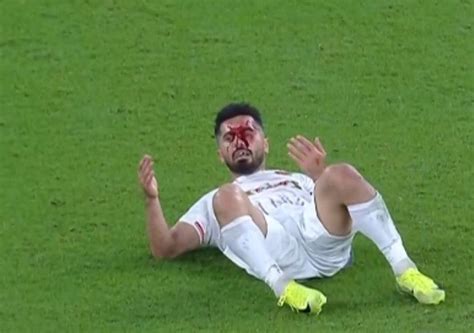 صحنه دلخراش کنده‌شدن دندان امید عالیشاه صورت کاپیتان غرق در خون شد فیلم