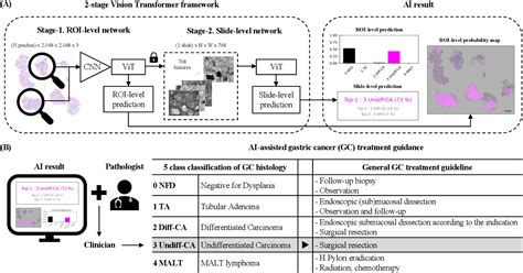 Figure 1 From Multi Scale Hybrid Vision Transformer For Learning Gastric Cancer Histology
