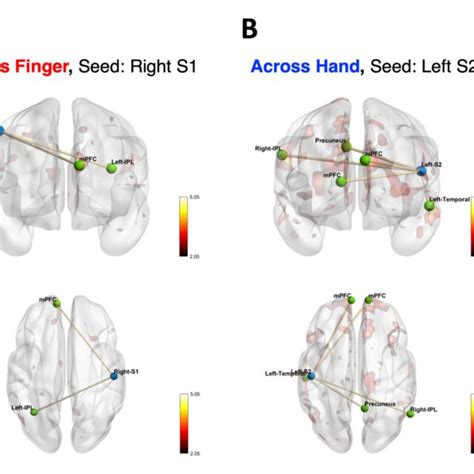 Brain Connectivity Results Of The Generalized Psycho Physiological Download Scientific Diagram