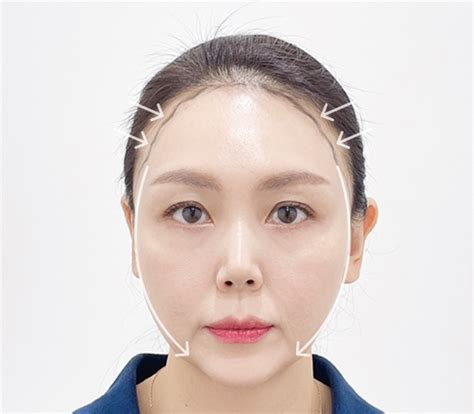 작은얼굴 컨설팅