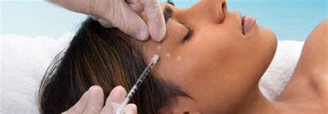 Biologic Injections Vitalskin Dermatology