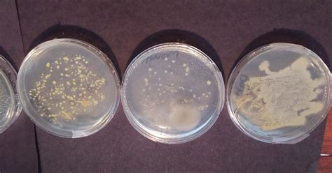The Cool Science Dad Science Fair Project Bacterial Growth Day 4