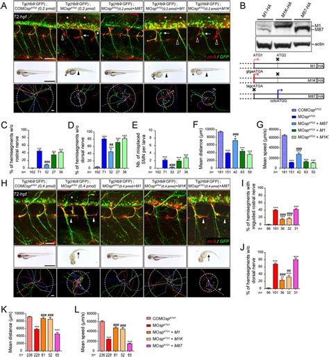 Spastin Main Isoforms Have Non Overlapping Functions In Spinal Motor Download Scientific