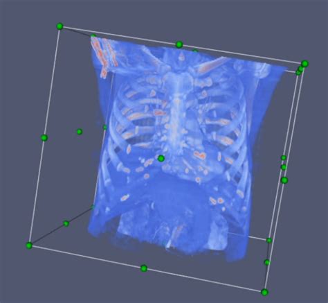 Vtkjs Video Tutorials Integrating Scientific Visualizations Into Ohif