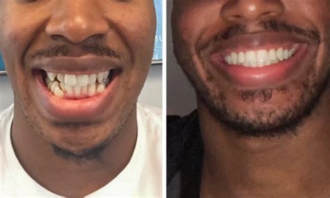 За сите оние кои се двоумат дали да го направат тоа 13 презадоволни луѓе кои добија сосема нова