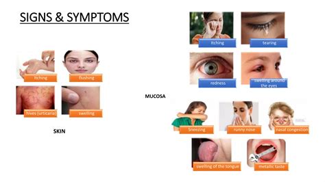 Anaphylactic Shock PPTX