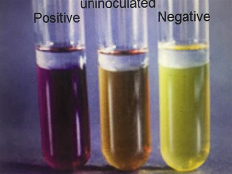 Lab Practical Three Flashcards Quizlet Lab Practical Three Flashcards Quizlet