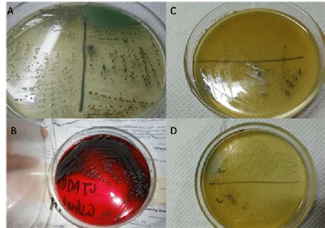 Conventional Method Of Detecting Salmonella Spp From Unbranded Fresh