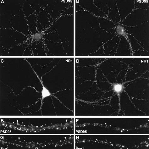 Preservation Of Punctate Staining For Proteins Of The Postsynaptic Download Scientific Diagram