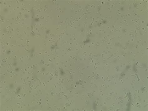 Enterococcus Avium Introduction Morphology Pathogenicity Lab Diag