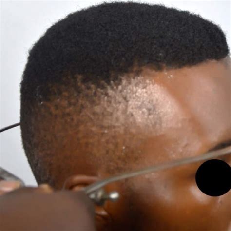 Measurement Of Head Width Download Scientific Diagram